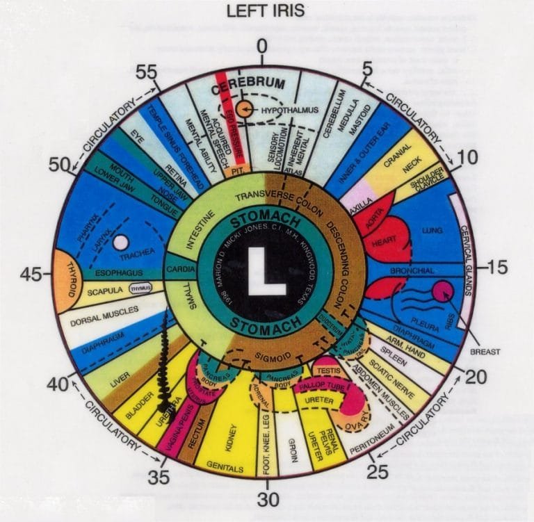 Left Iris Chart: Complete Guide To Asymmetrical Health Analysis