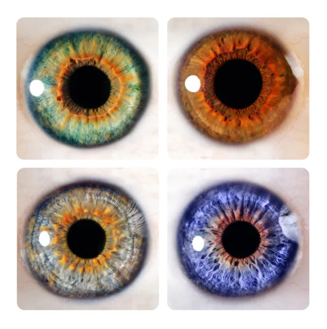 What Is An Iridologist? A Guide To Iris Diagnosis Practices