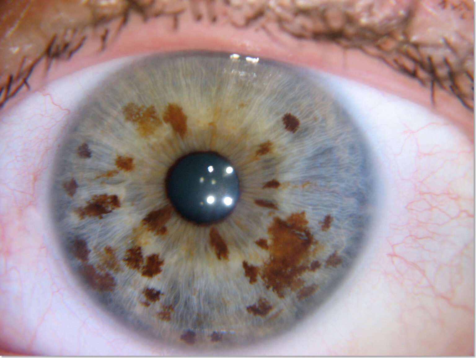 Eye Patterns Iris: Unlocking Eye Uniqueness