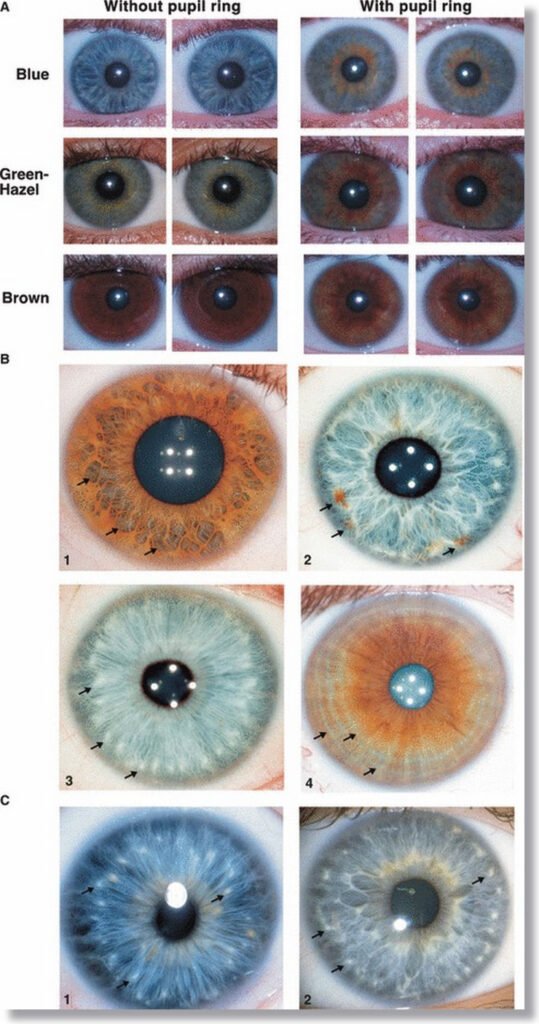 What Is Iridology? Understanding The Study Of The Iris