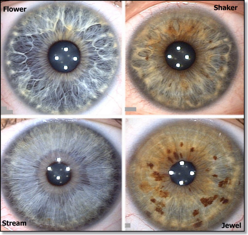 How To Read An Iridology Iris Chart Like A Professional