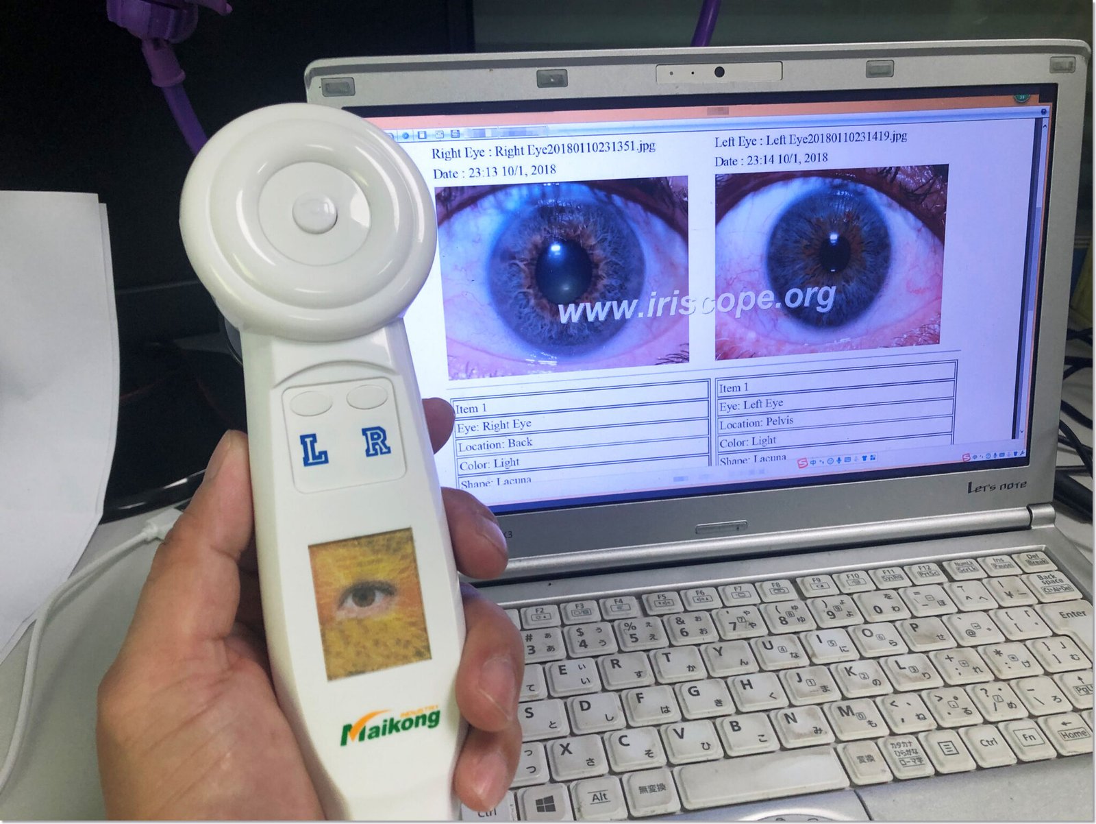 MAIKONG Iridology Camera & Iriscope - Leading Manufacturer – MAIKONG Iridology Camera - Iriscope ...