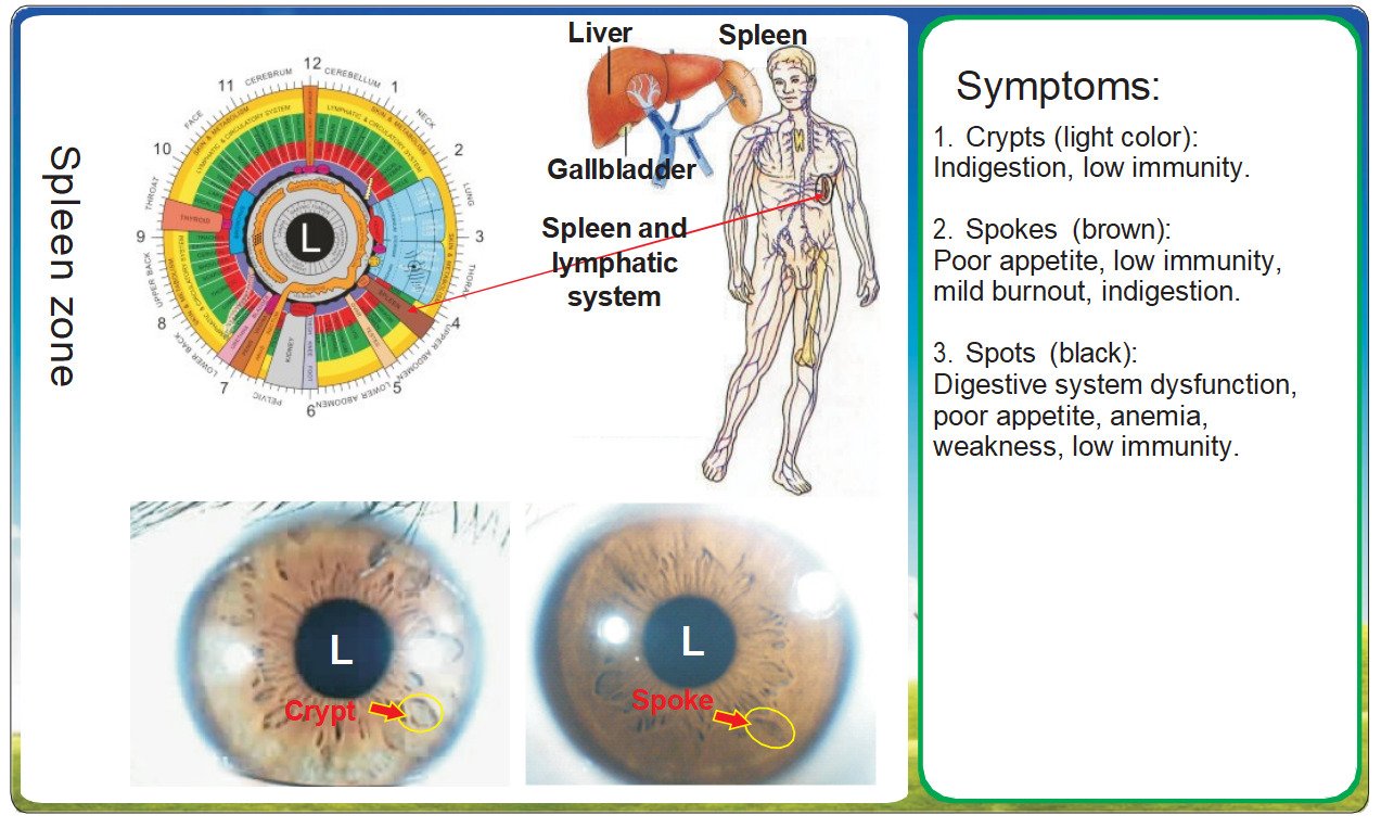 Iridology Chart Right Eye: Complete Guide To Health Mapping