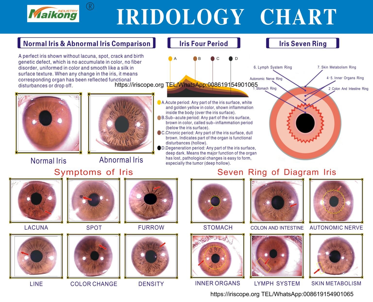 Iridology Chart For Beginners: Easy Interpretation Guide
