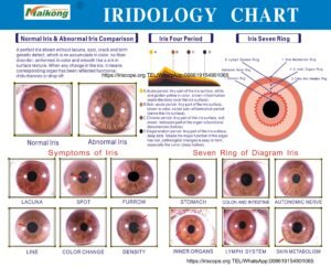 Iridology Chart Symbols And Their Meanings: Complete Guide